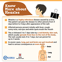Centre for Health Protection - Know More about Measles Infographics